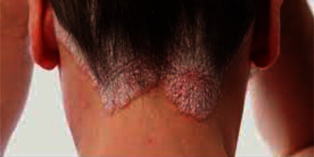 17 Bienfaits Du Curcuma + Les Meilleurs Compléments